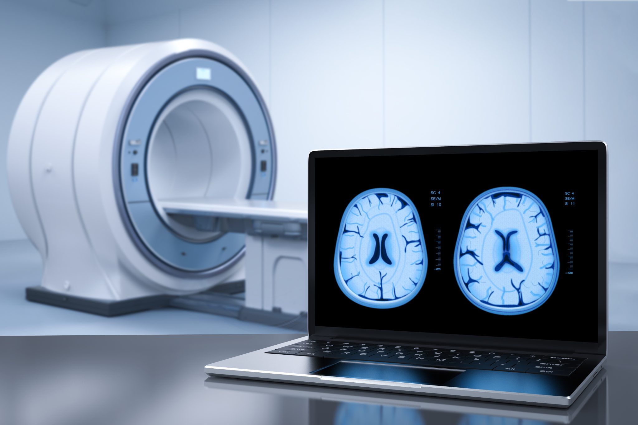 Preparing For An Mri Scan: What To Expect And How To Prepare