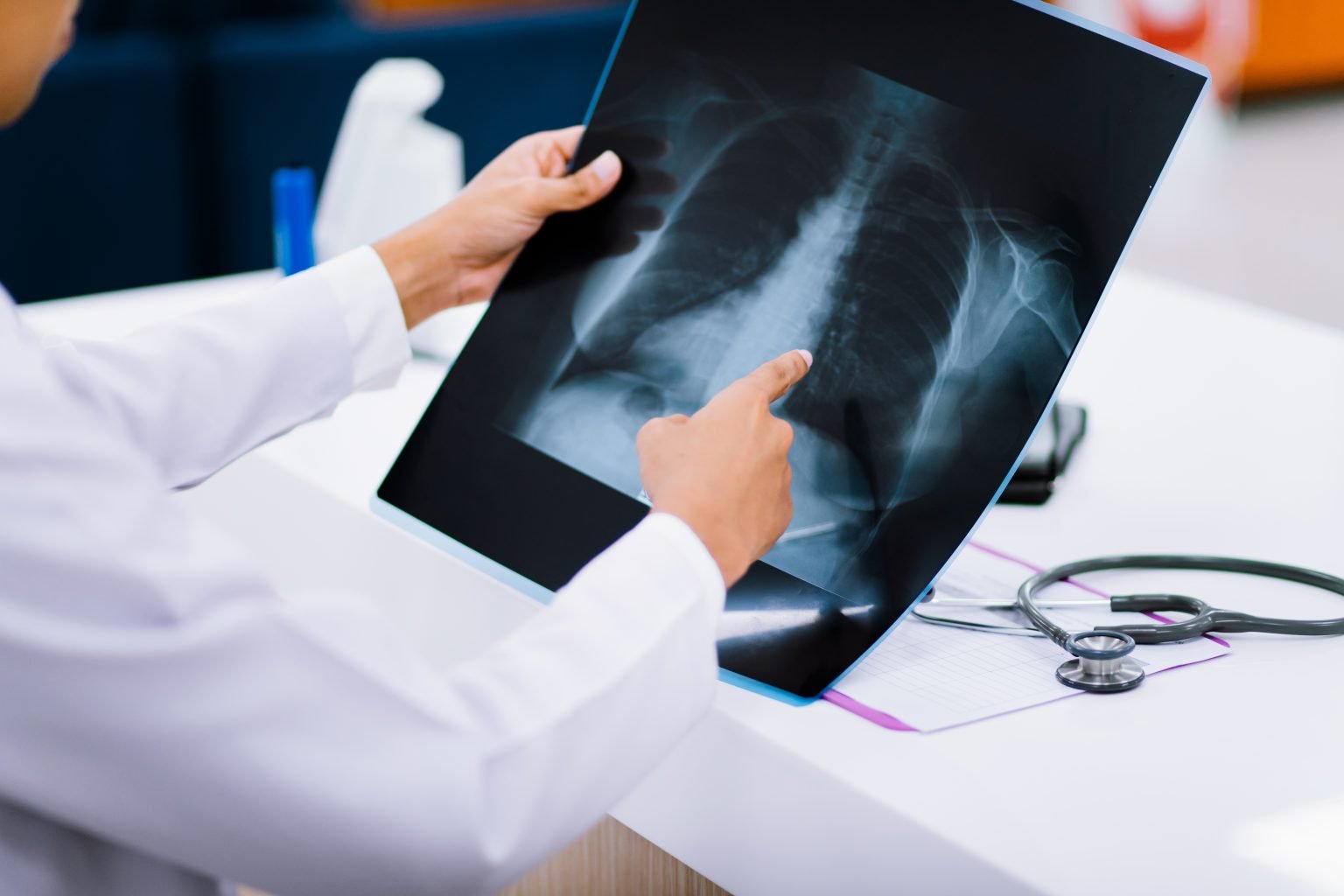 Understanding Bone Fracture X-Rays