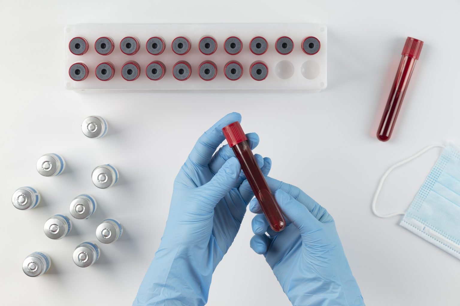 Guide to Understanding MCH, MCV, and MCHC Blood Tests